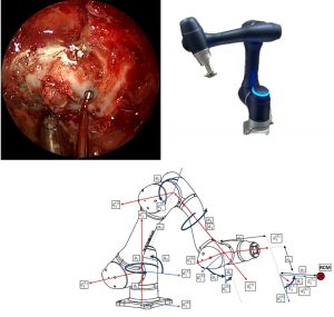 The Control of the Endoscope Router Robot to be used in Endonasl ...